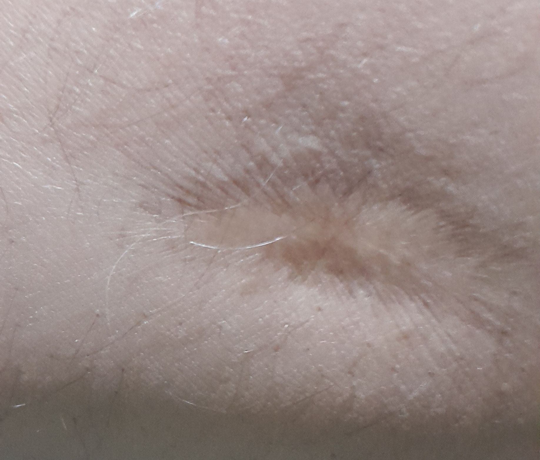 “A Minor Surgery… But a Deep Scar of Memories…!” – avatibhavati.com